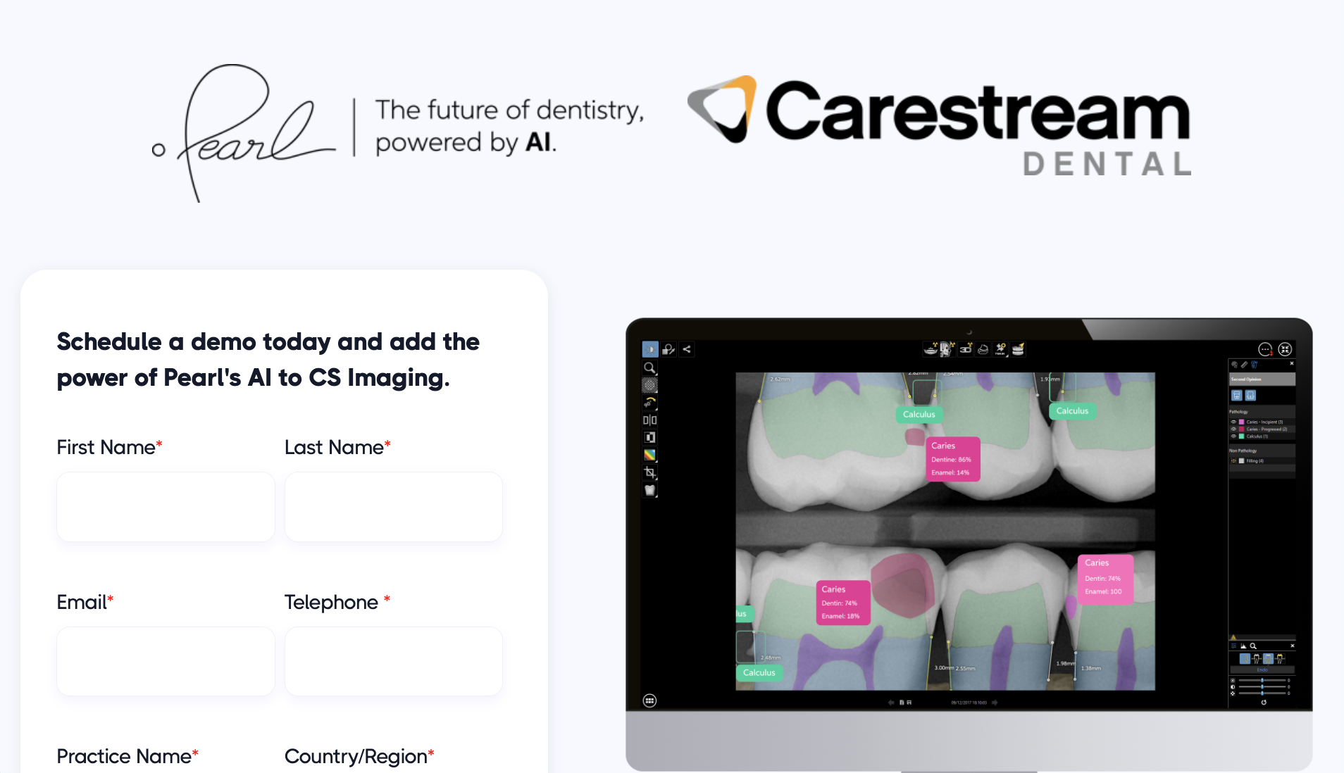 Pearl | AI for Carestream Dental | Request a Pearl demo!